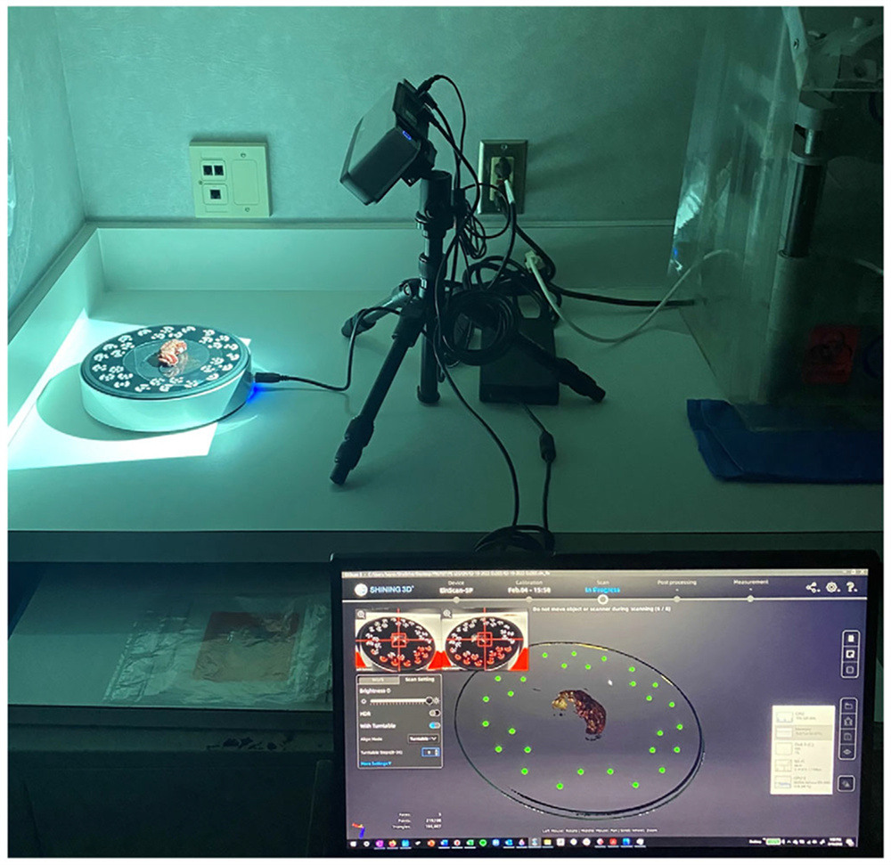 Improving Surgeons and Pathologists: 3D Scanning and Specimen Mapping