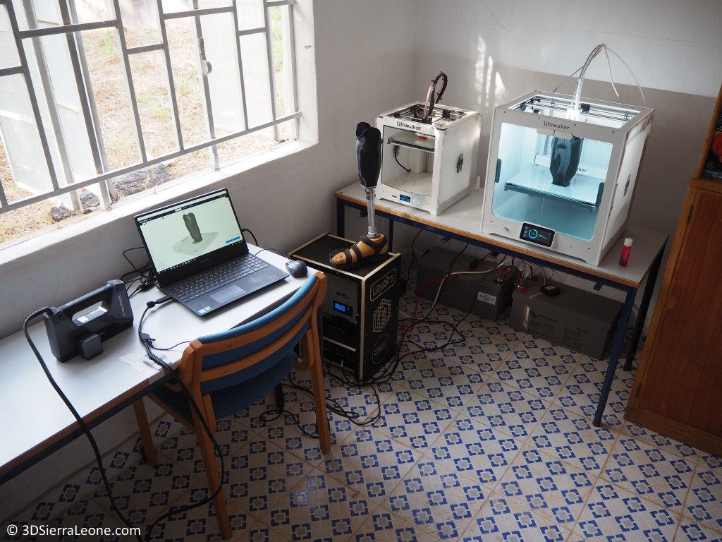 Creating 3D Printed Assistive Devices for Amputated Patients