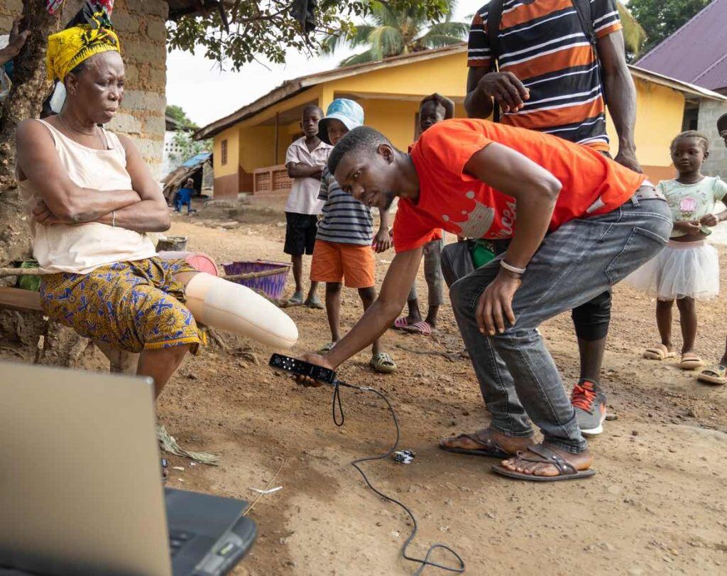 Creating 3D Printed Assistive Devices for Amputated Patients