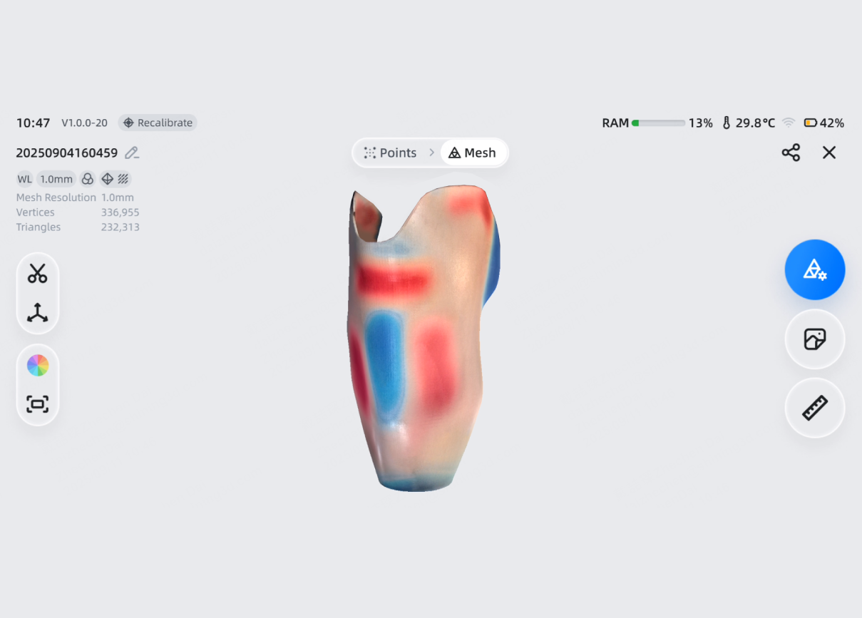 3D Scanner EinScan Medixa丨For Orthotics & Prosthetics Care丨SHINING 3D